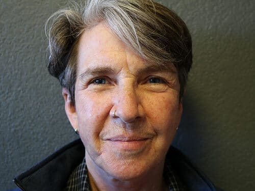 Facelift Archives - Jennifer Boll, MD